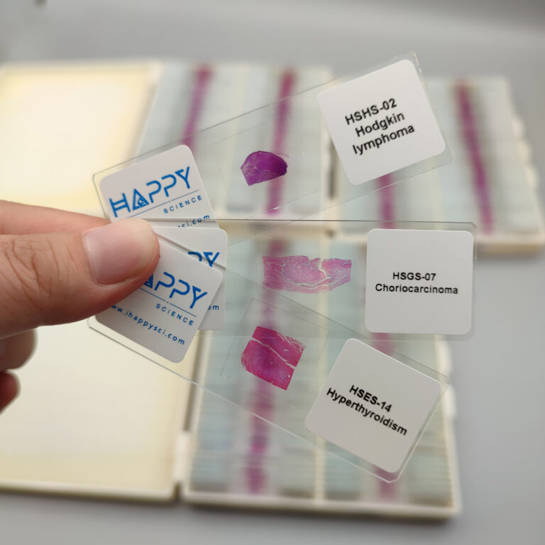 High Resolution Scan Copies Of Pathology Slides Digital Pathology Slides
