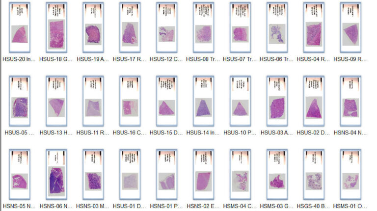 High-resolution scan copies of pathology slides, digital pathology slides
