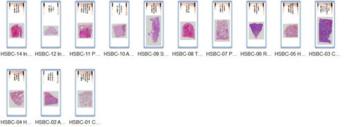 High-resolution scan copies of pathology slides, digital pathology slides